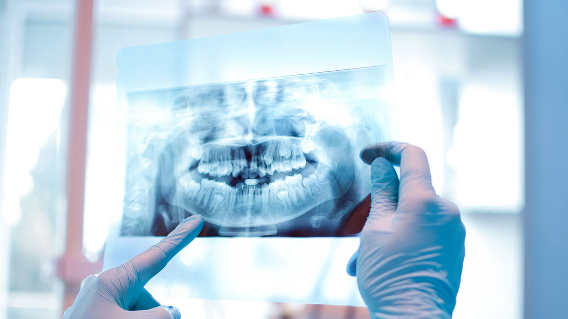 X-Ray and Panoramic Radiography - Dentalogos Oral and Dental Health Clinic